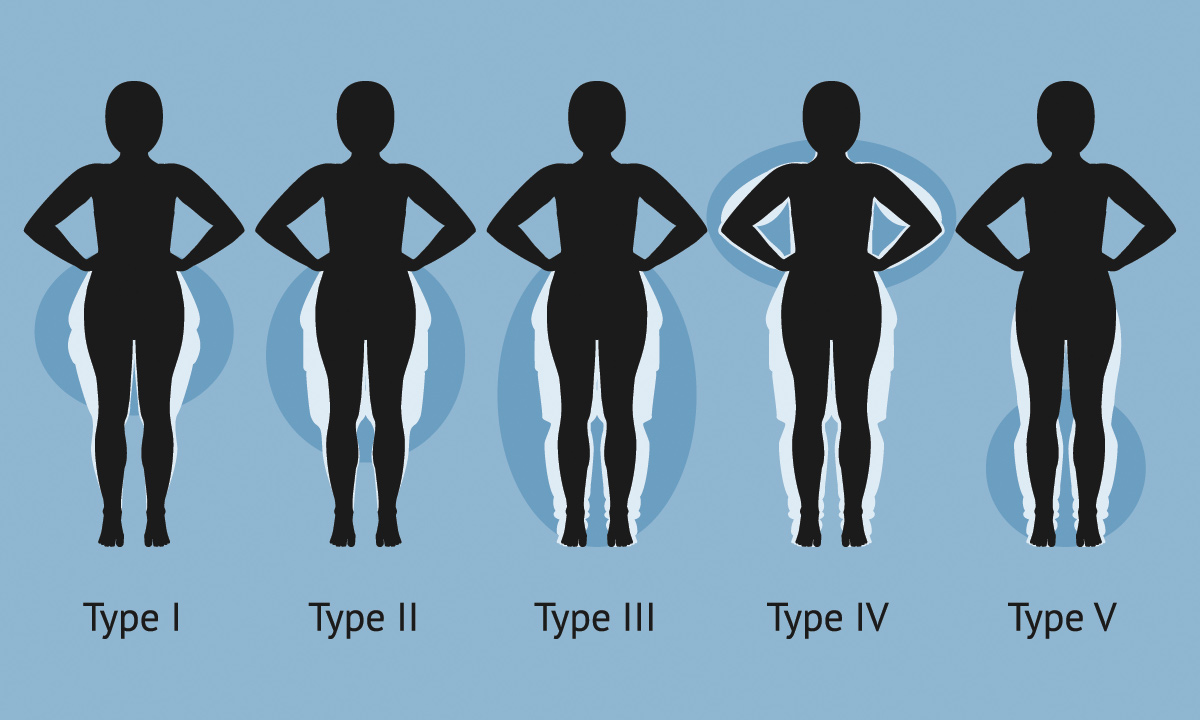 Lipoedeem is een ziekte en geen eetstoornis - Clinique Dokter Don